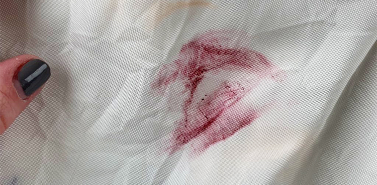 Woman all praises for her lipstick as it stays even after car crash